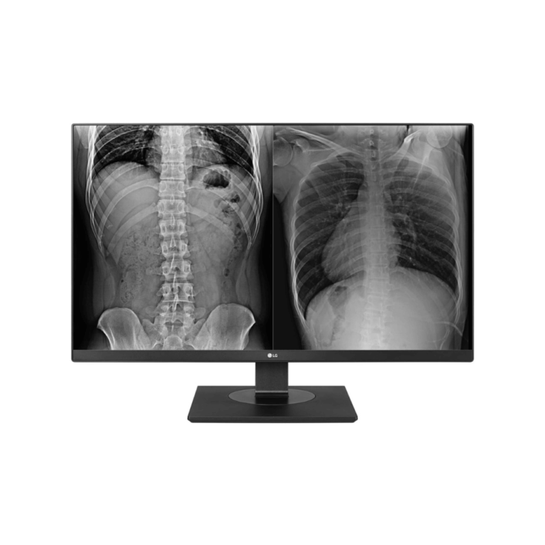 8MP Clinical Review Monitor | MDI Medical