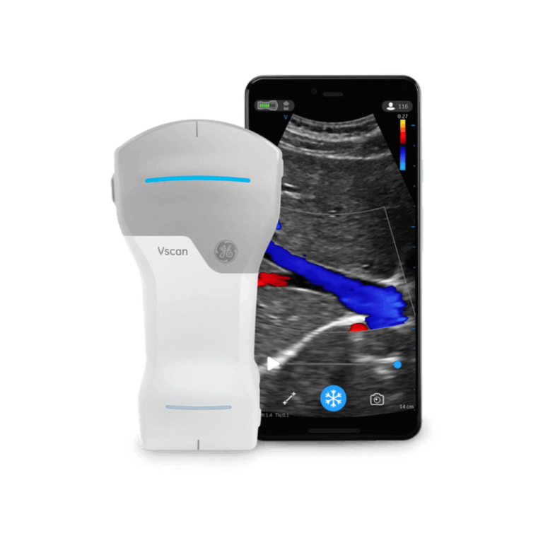 Vscan Air | MDI Medical