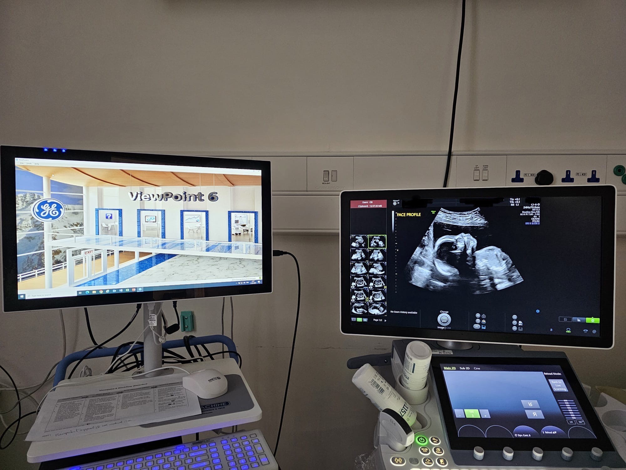 MDI Medical Celebrates Successful Implementation of Viewpoint 6 OB/GYN ...